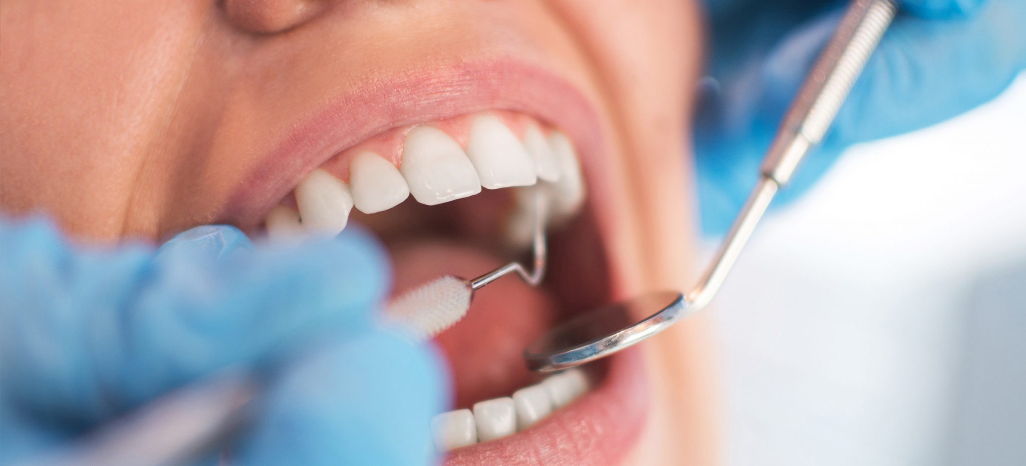 Fun Facts About Teeth & Oral Health | Reno Dental Associates